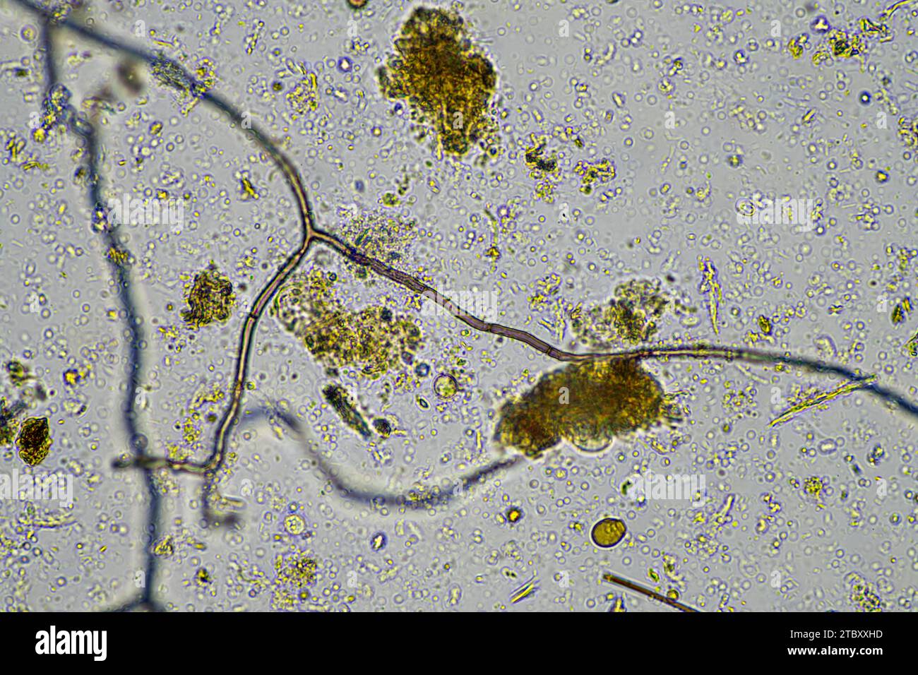 soil microbes under the microscope. microorganisms with fungus in ...