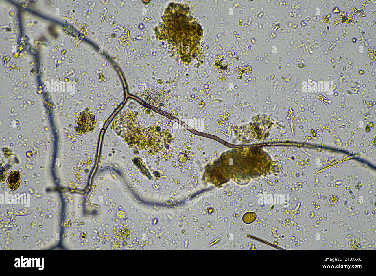 microscopic microorganisms under the microscope Stock Photo - Alamy