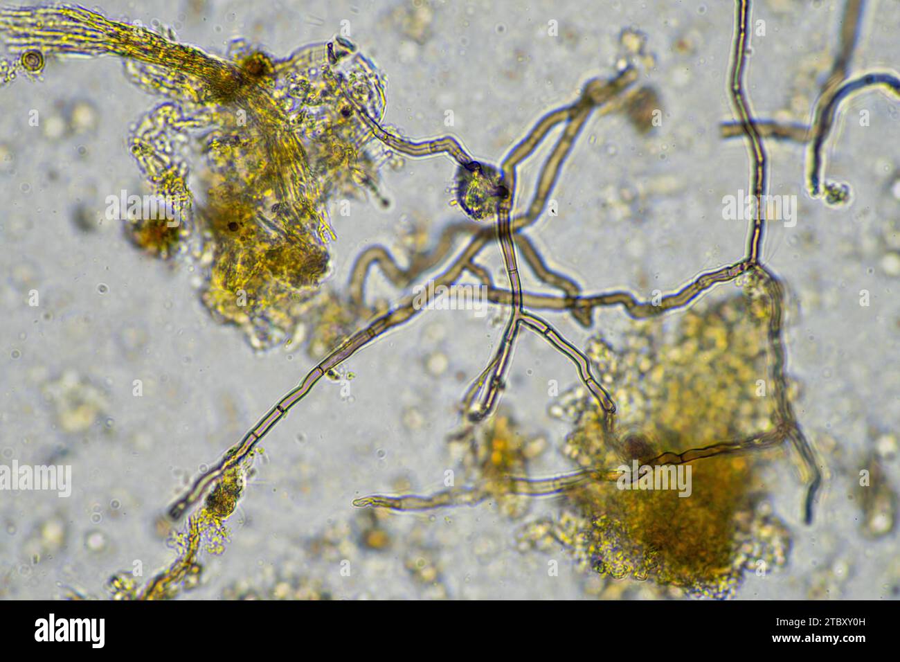 microscopic microorganisms under the microscope Stock Photo - Alamy