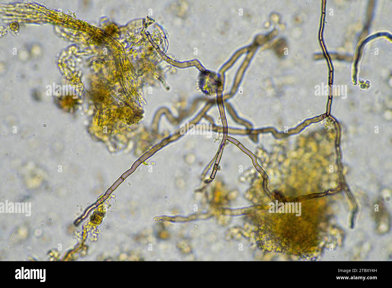 microscopic microorganisms under the microscope Stock Photo - Alamy