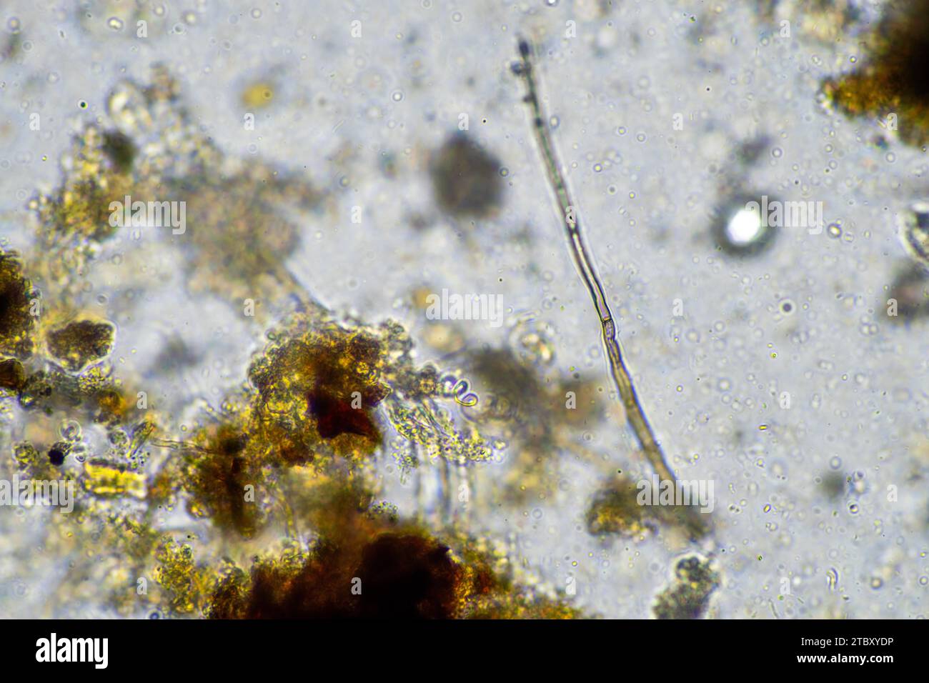 microscopic microorganisms under the microscope Stock Photo - Alamy