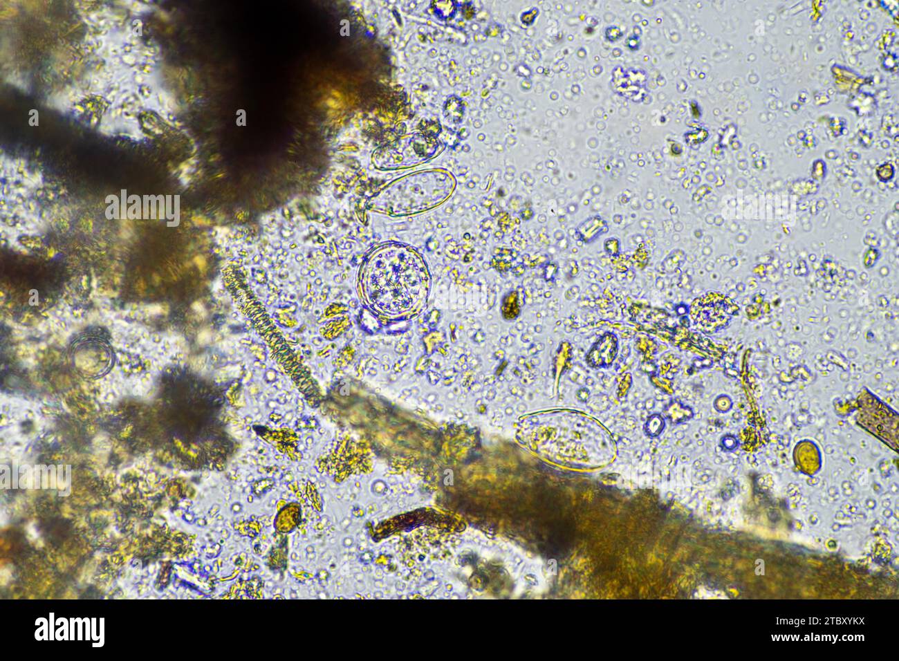 microscopic microorganisms under the microscope Stock Photo - Alamy