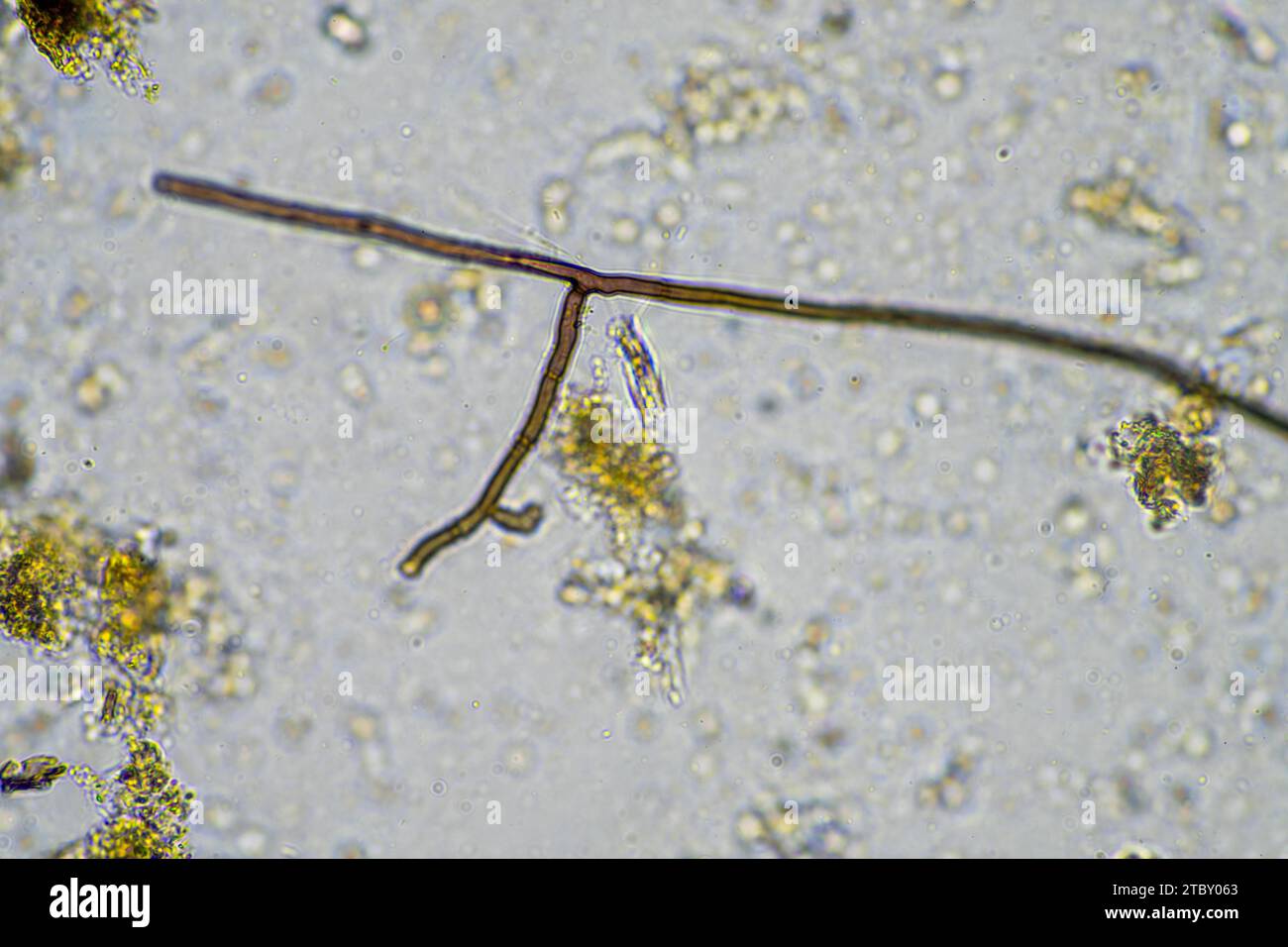 Microorganisms and biology in Compost and soil sample under the ...