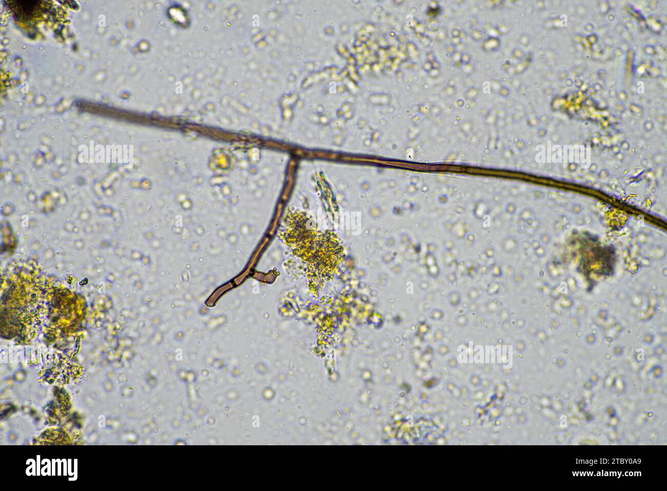 microscopic microorganisms under the microscope Stock Photo - Alamy