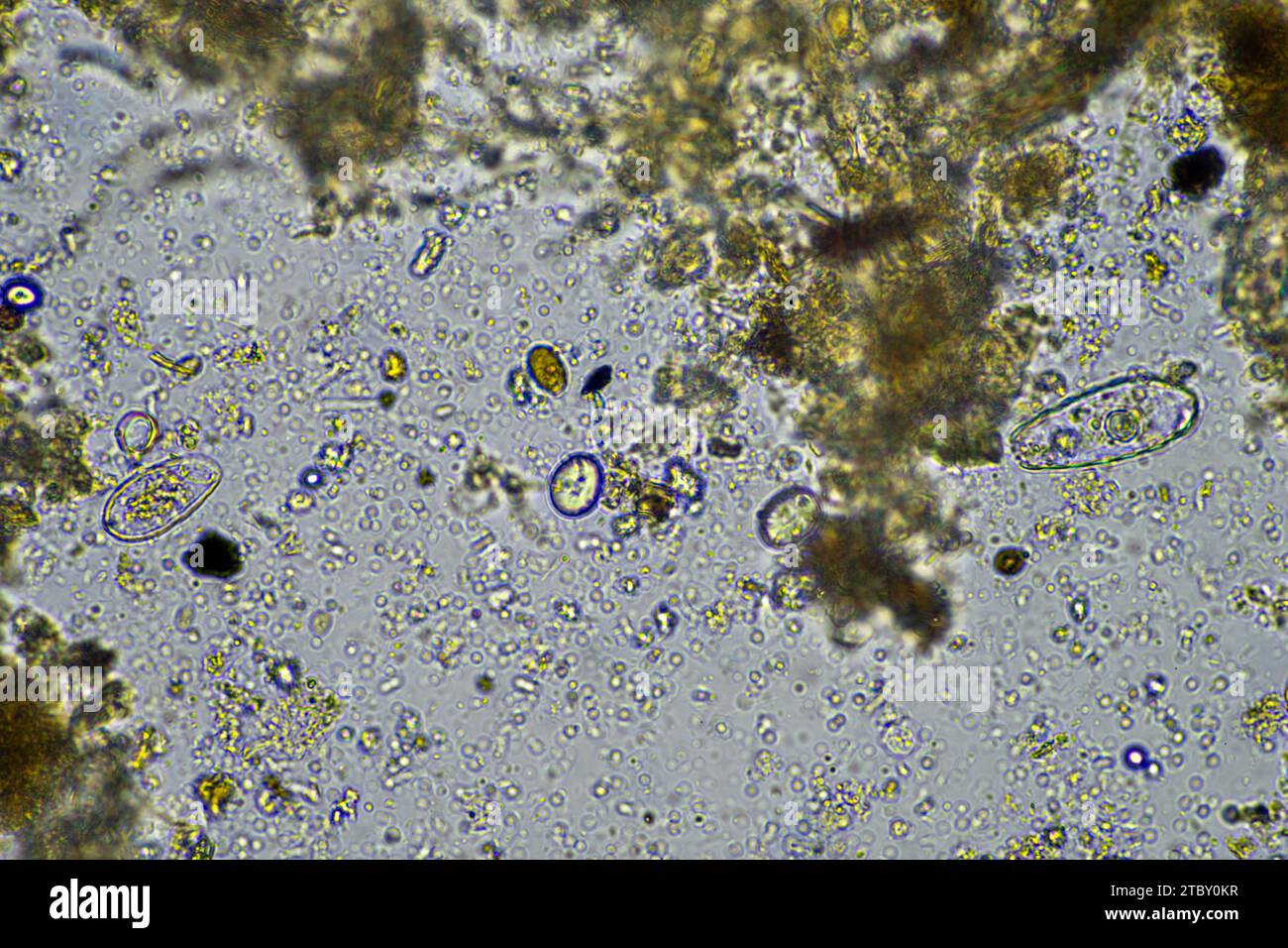 soil microbes under the microscope. microorganisms with fungus in ...