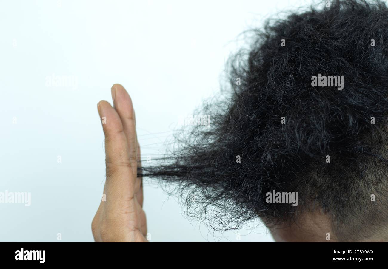 Close Up Young people have problems with hair loss, dryness, dullness ...