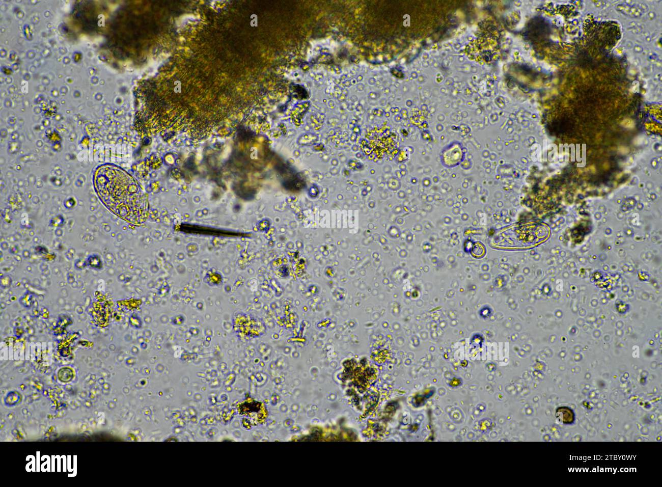 Microorganisms and biology in Compost and soil sample under the ...