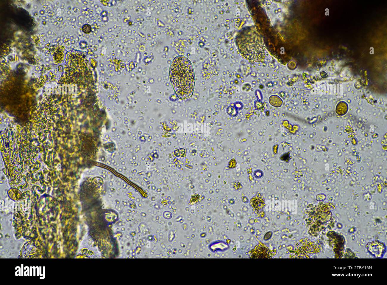 microscopic microorganisms under the microscope Stock Photo - Alamy