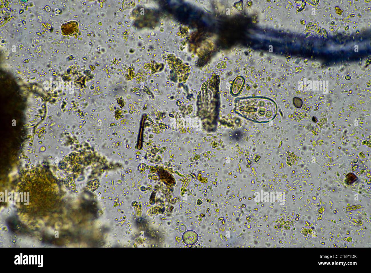 soil microbes under the microscope. microorganisms with fungus in ...