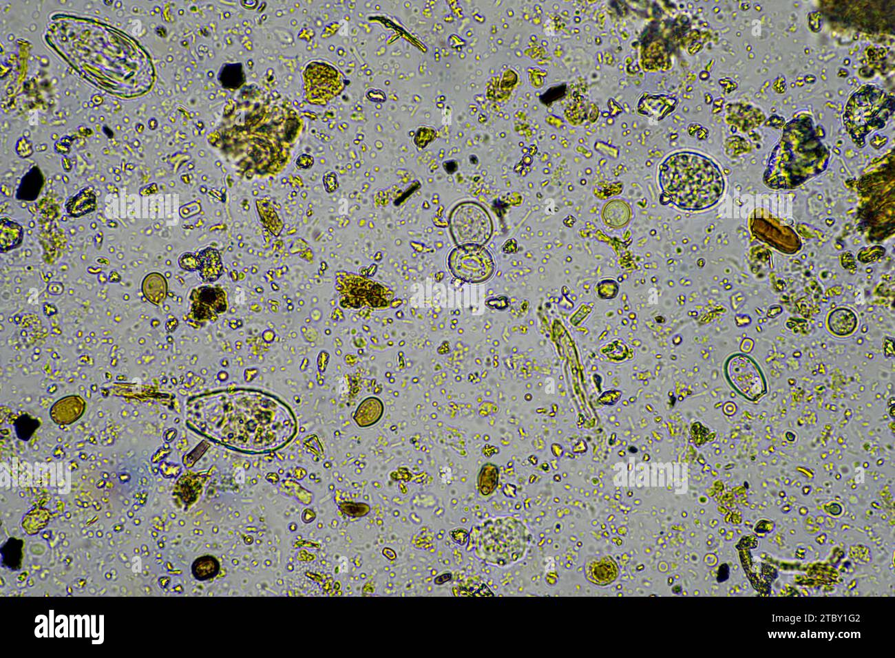 soil microbes under the microscope. microorganisms with fungus in ...