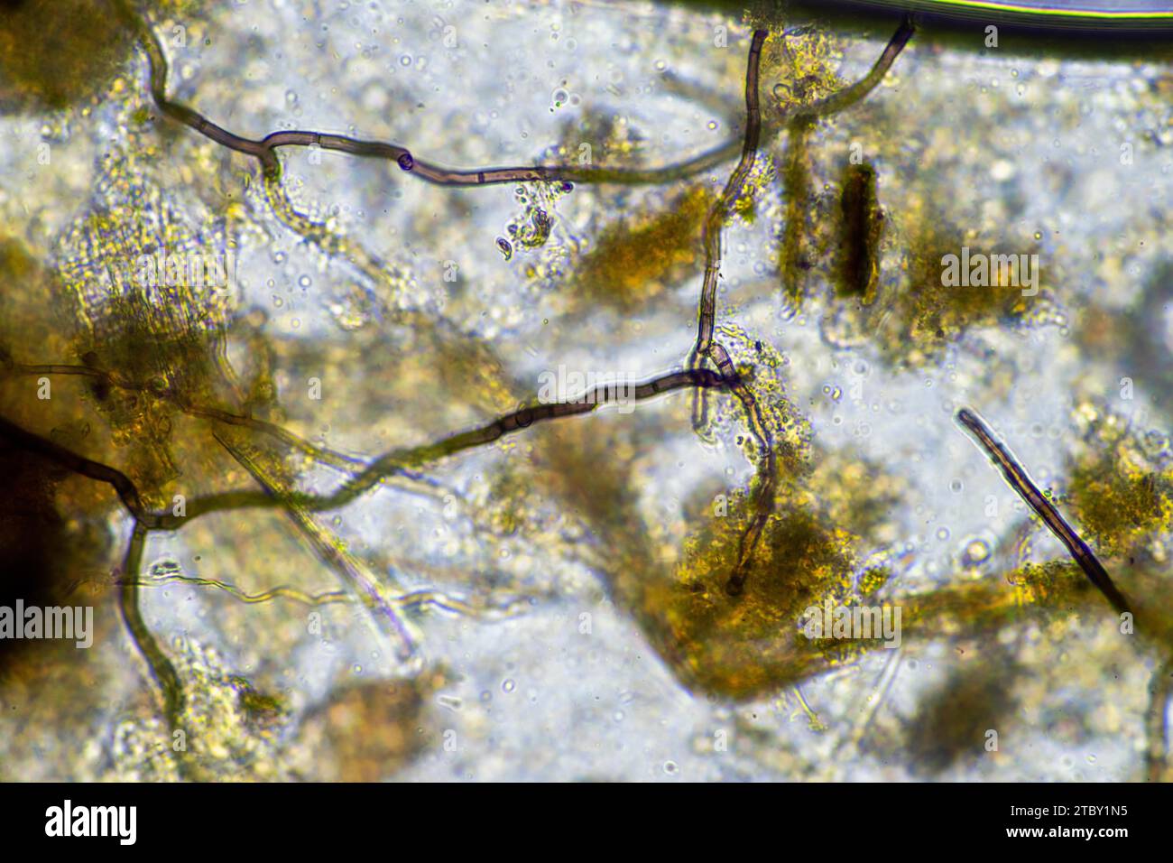Microorganisms and biology in Compost and soil sample under the ...
