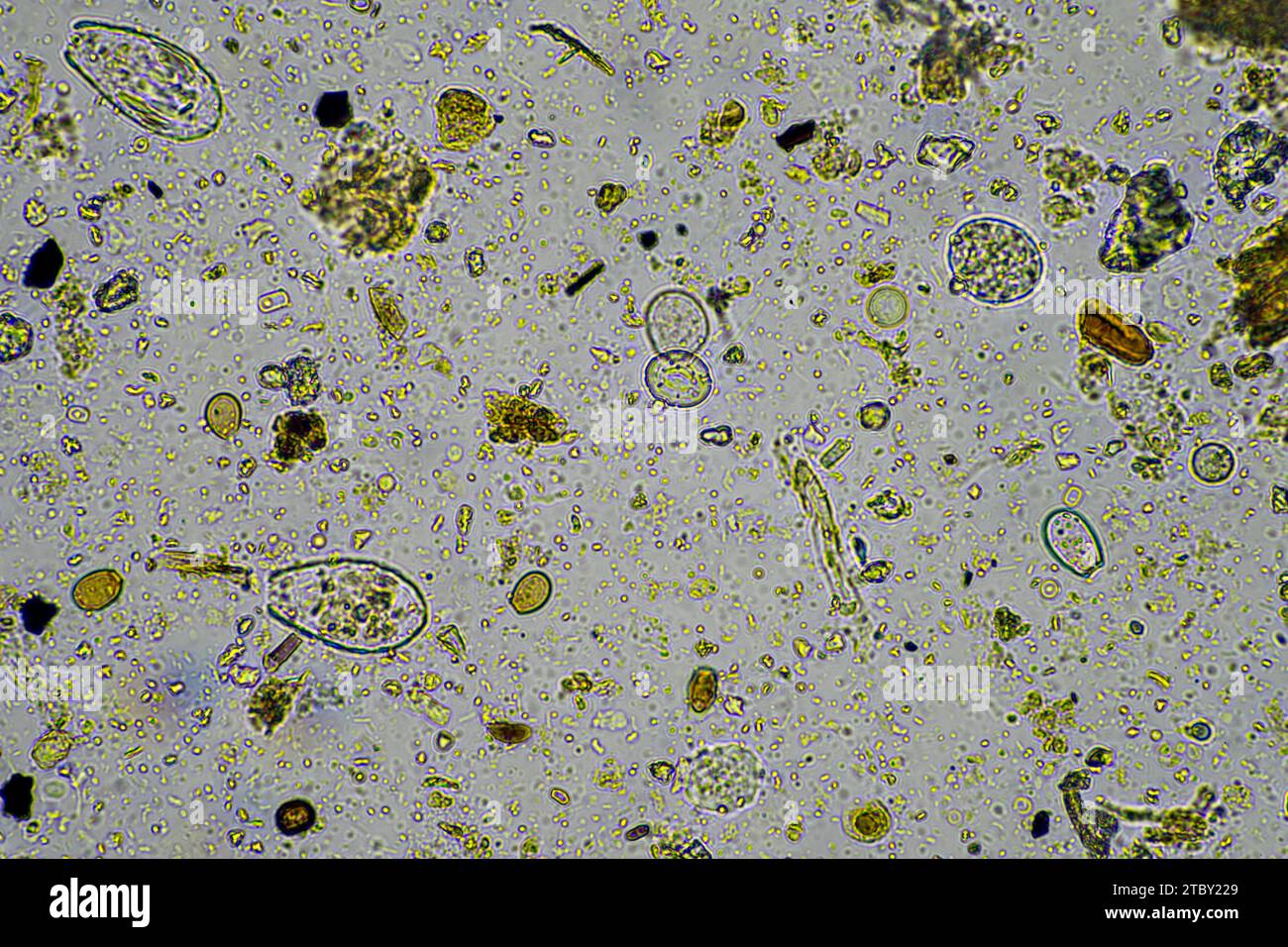 Microorganisms and biology in Compost and soil sample under the ...