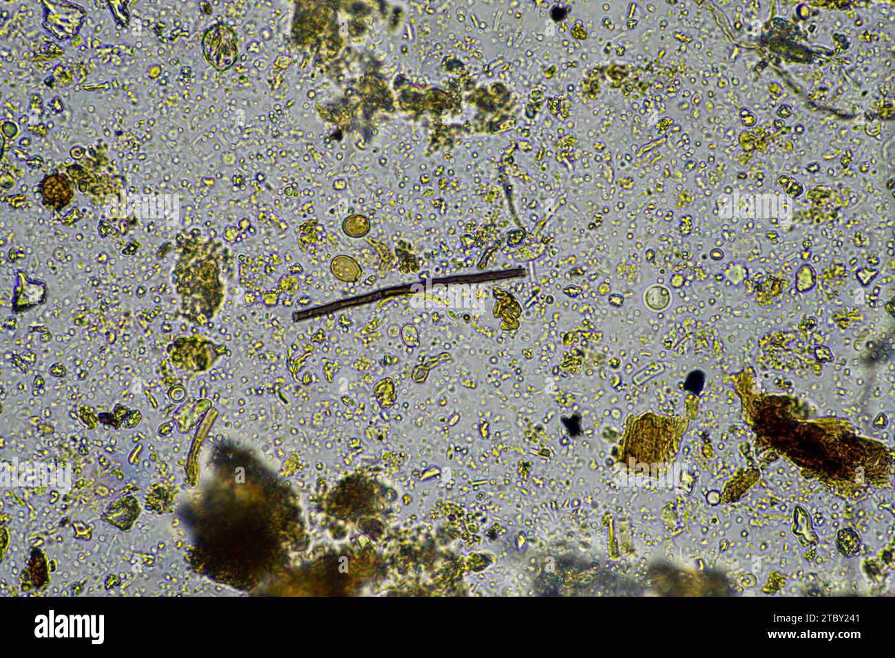 soil microbes under the microscope. microorganisms with fungus in ...