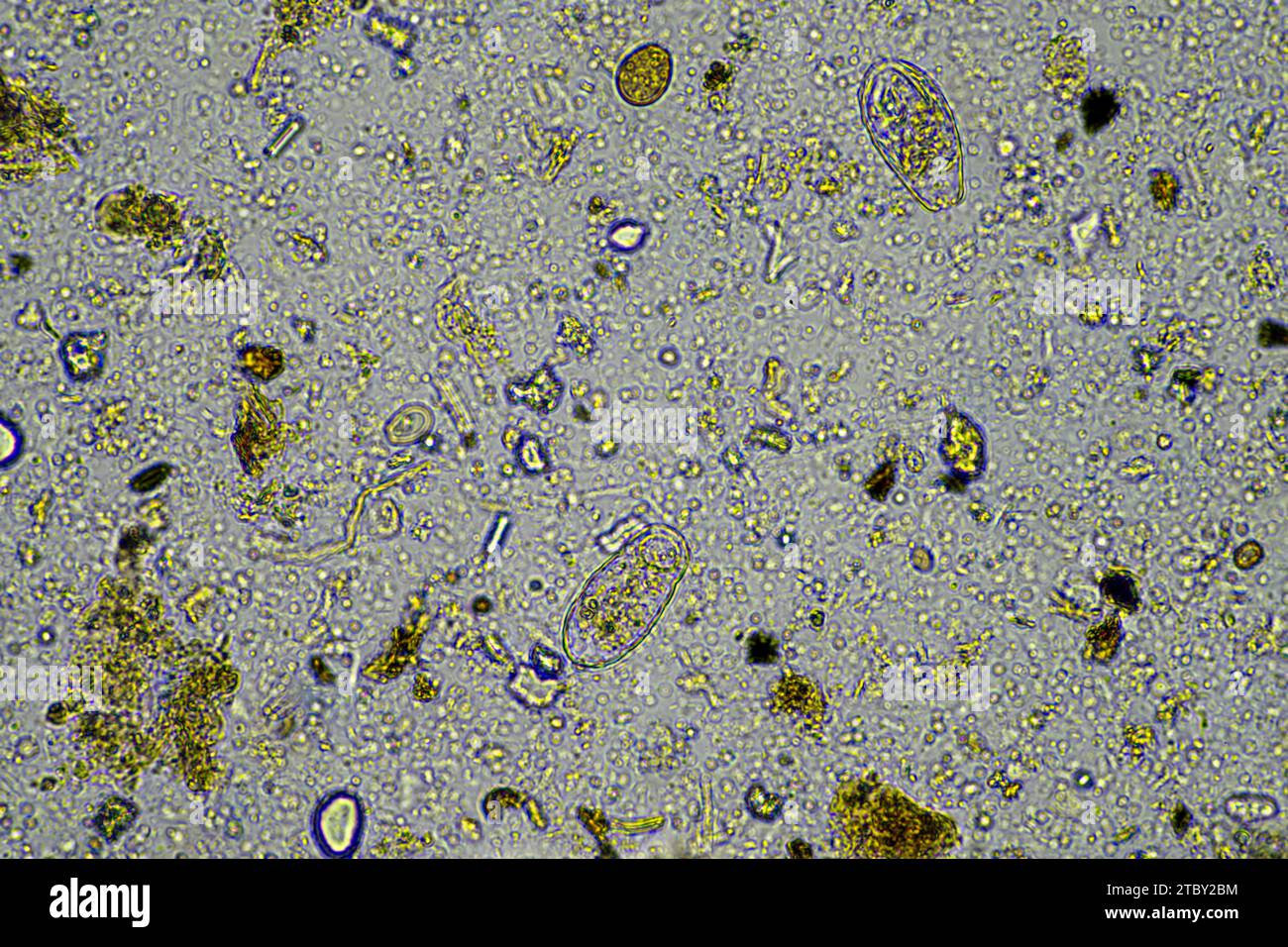 microscopic microorganisms under the microscope Stock Photo - Alamy