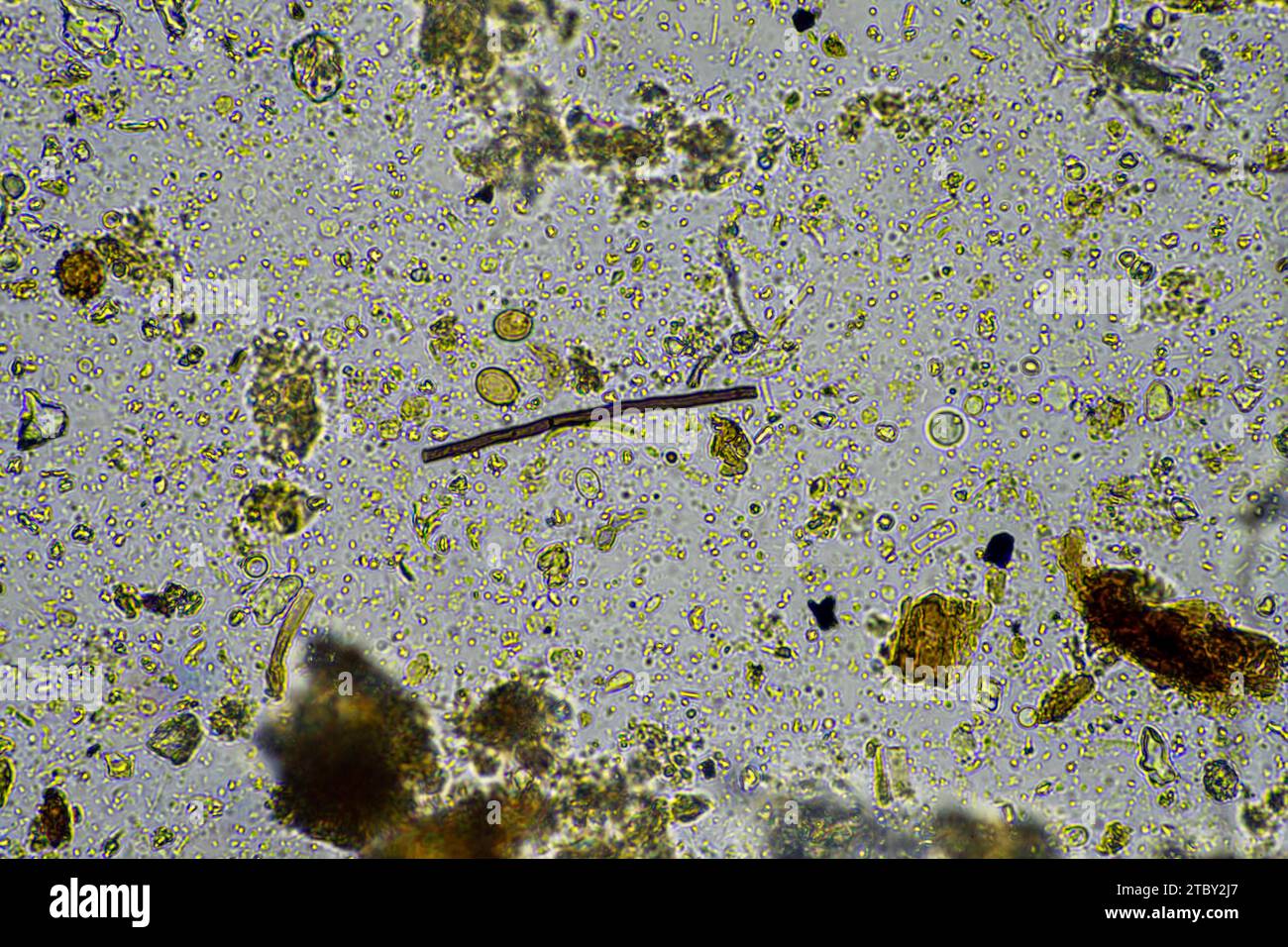 microscopic microorganisms under the microscope Stock Photo - Alamy