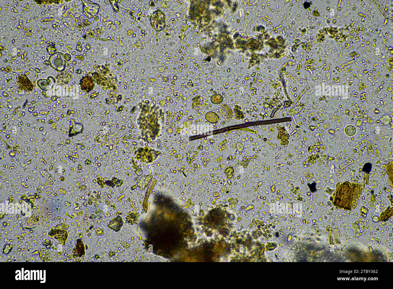 microscopic microorganisms under the microscope Stock Photo - Alamy
