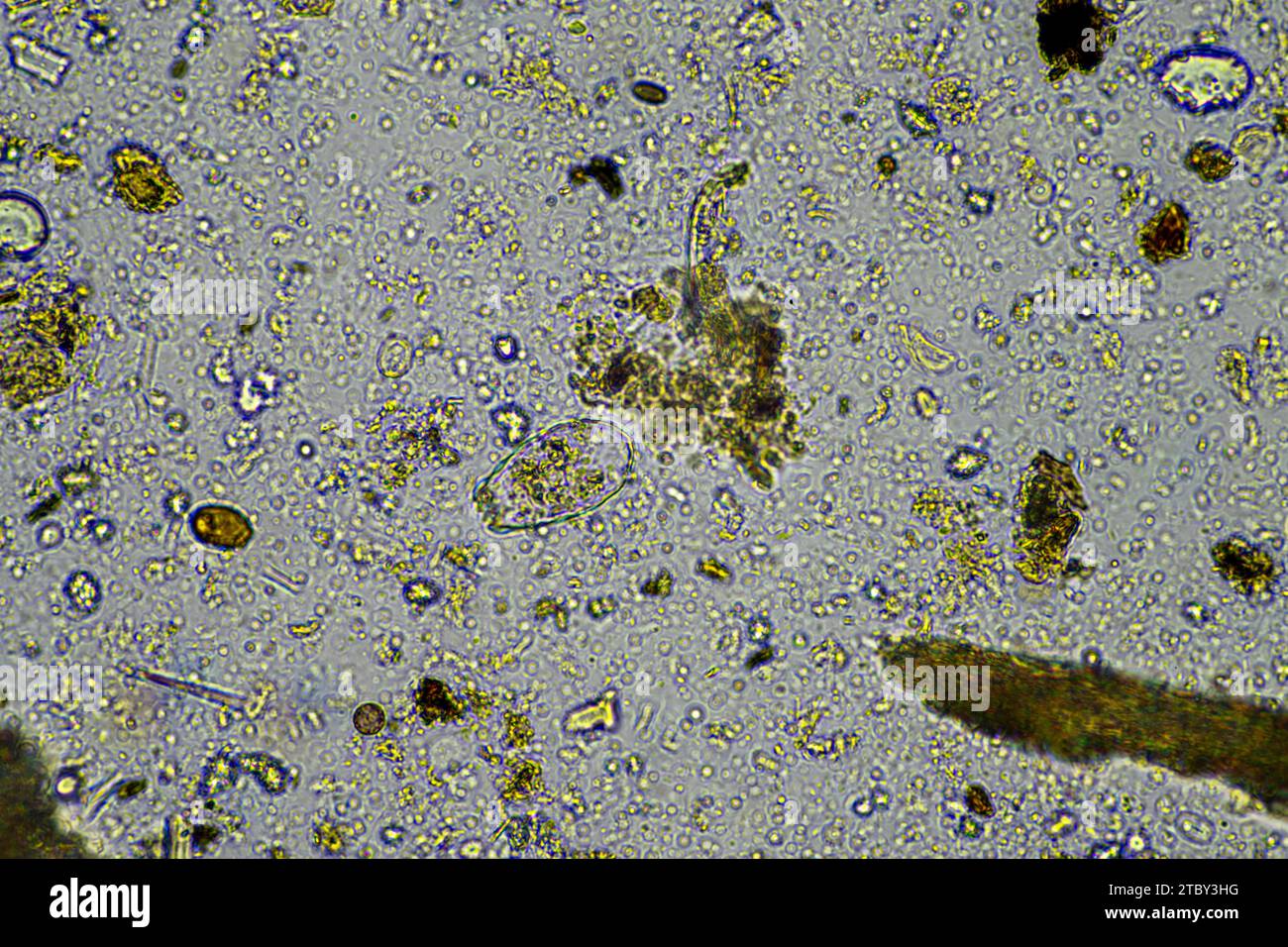 microscopic microorganisms under the microscope Stock Photo - Alamy