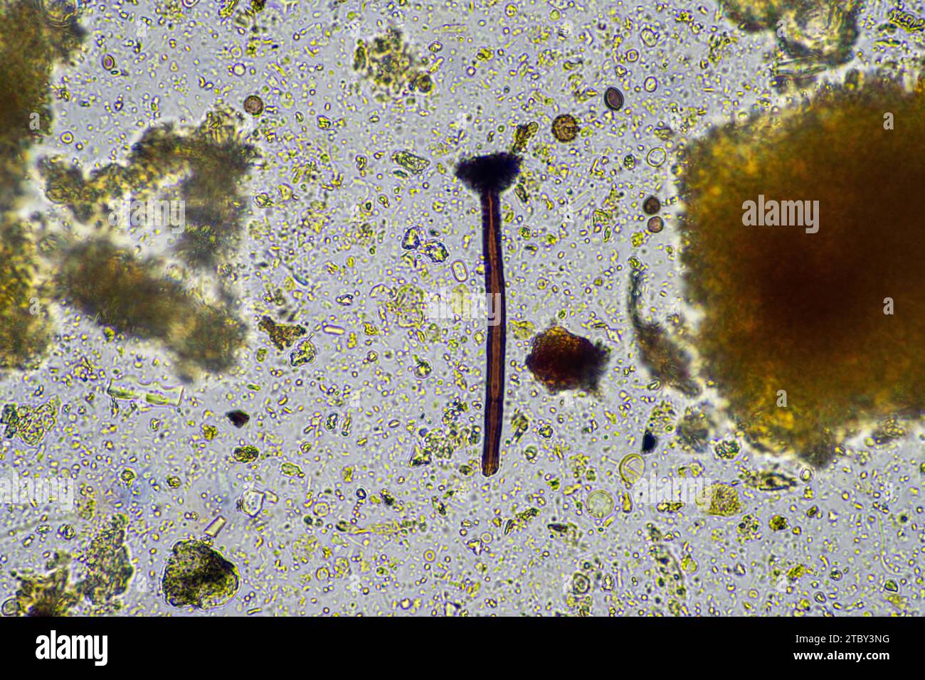 soil microbes under the microscope. microorganisms with fungus in ...
