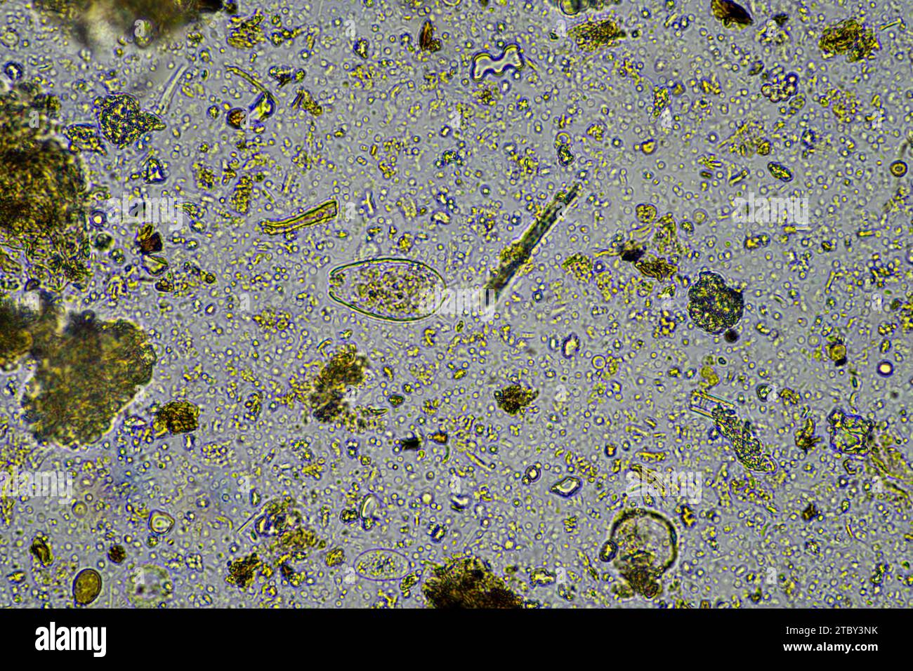 Microorganisms and biology in Compost and soil sample under the ...