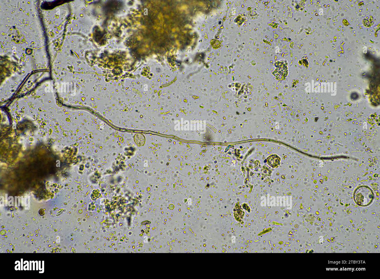Microorganisms and biology in Compost and soil sample under the ...