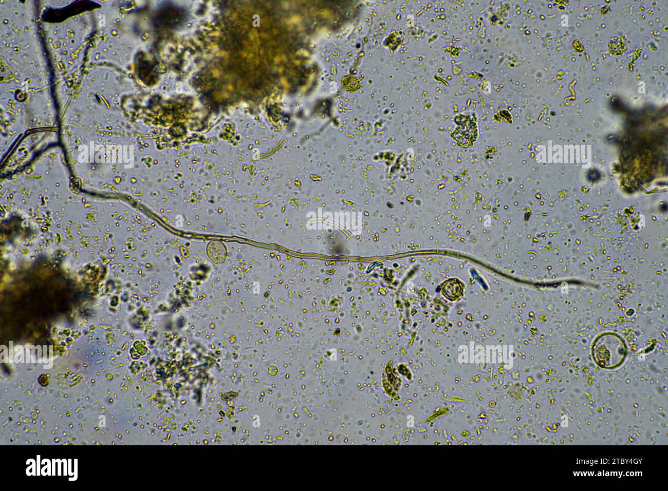 soil microbes under the microscope. microorganisms with fungus in ...