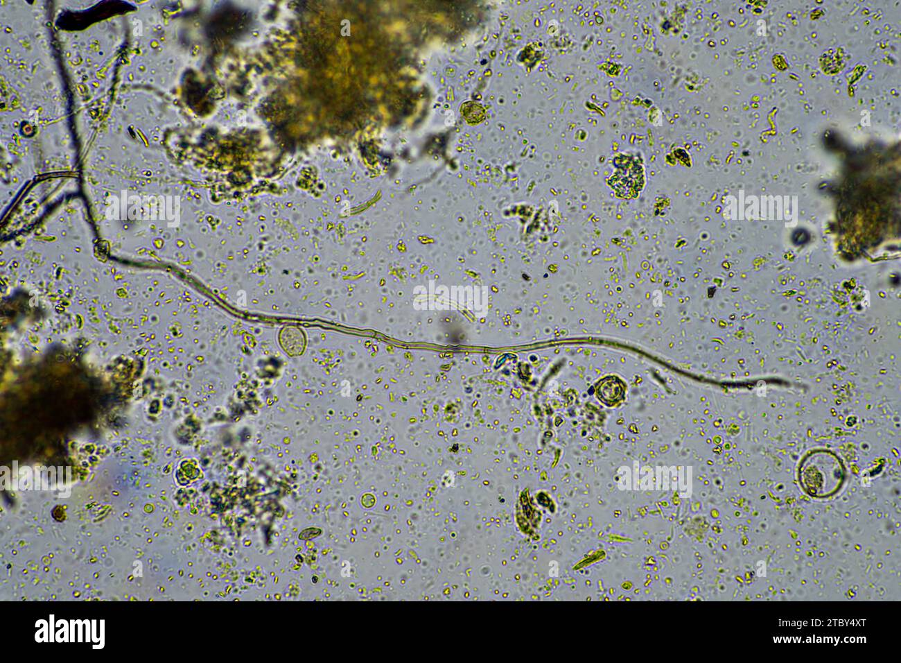 microscopic microorganisms under the microscope Stock Photo - Alamy