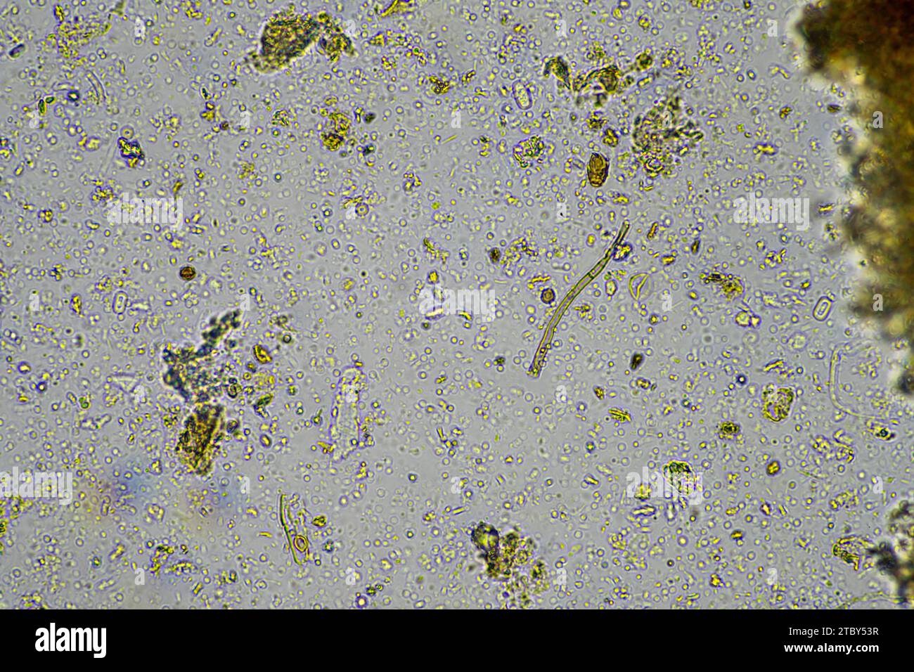 Microorganisms and biology in Compost and soil sample under the ...