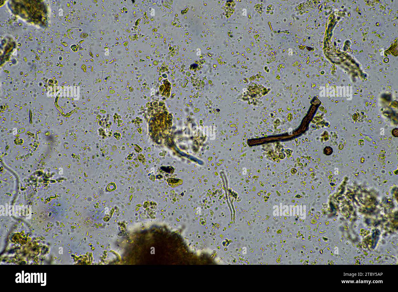 soil microbes under the microscope. microorganisms with fungus in ...