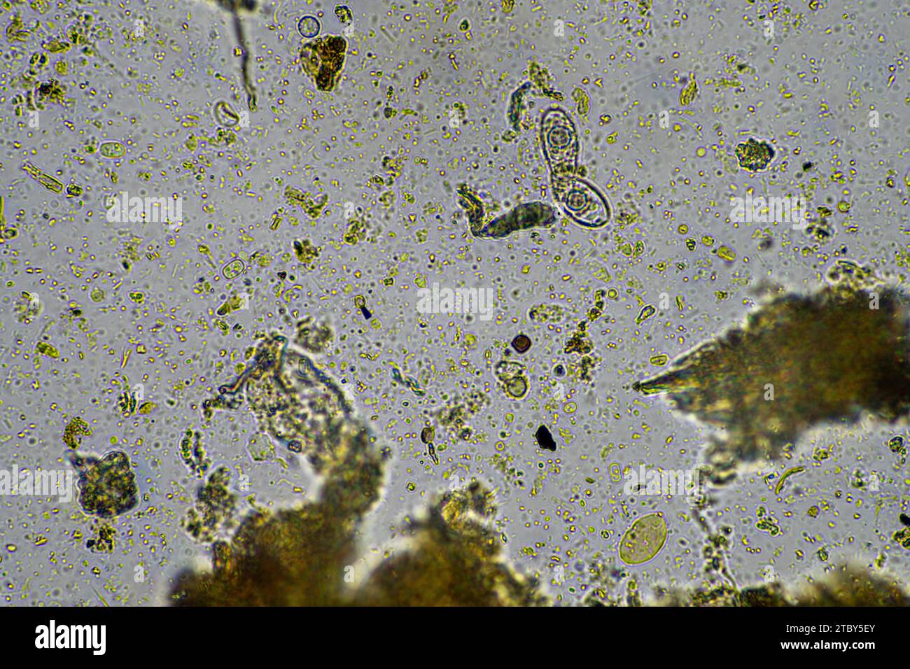 microscopic microorganisms under the microscope Stock Photo - Alamy