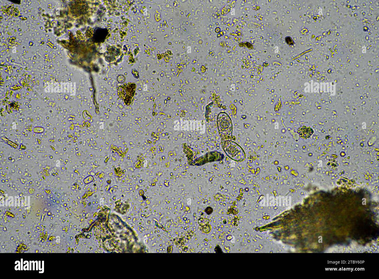 soil microbes under the microscope. microorganisms with fungus in ...