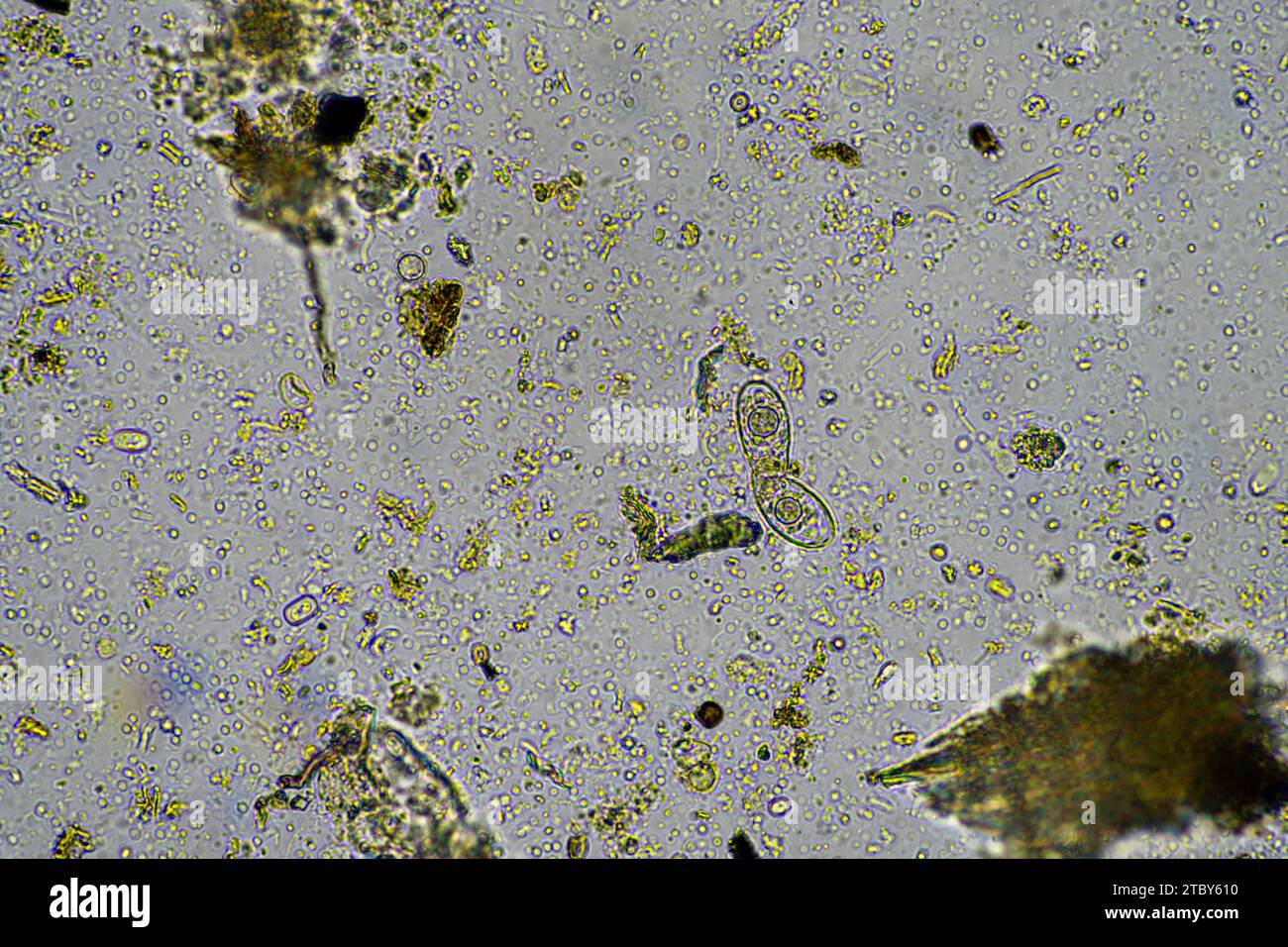 Microorganisms and biology in Compost and soil sample under the ...