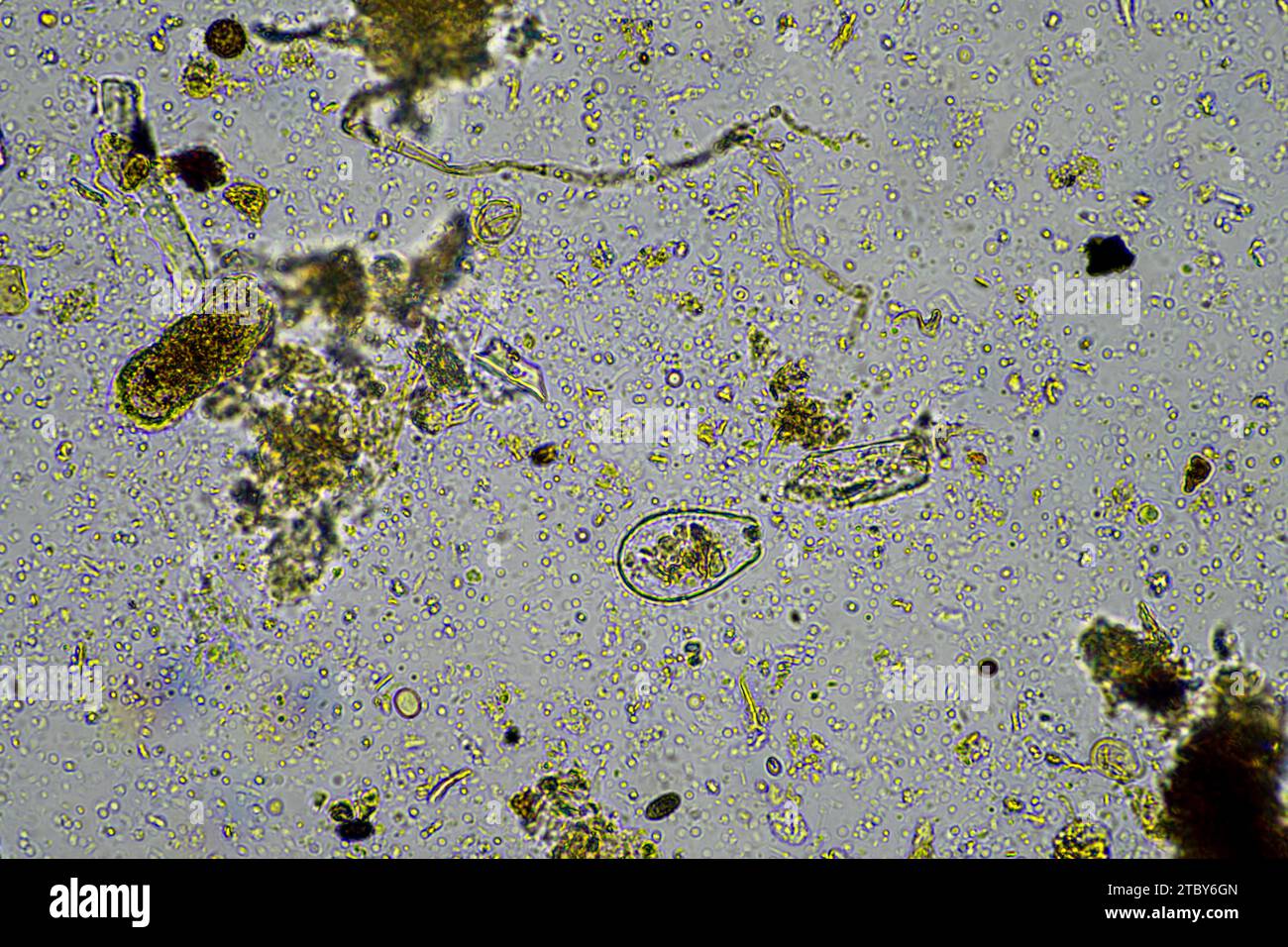 microscopic microorganisms under the microscope Stock Photo - Alamy