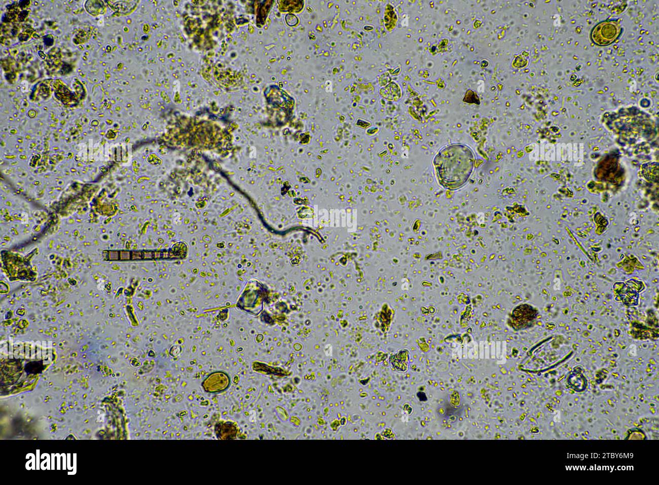 microscopic microorganisms under the microscope Stock Photo - Alamy