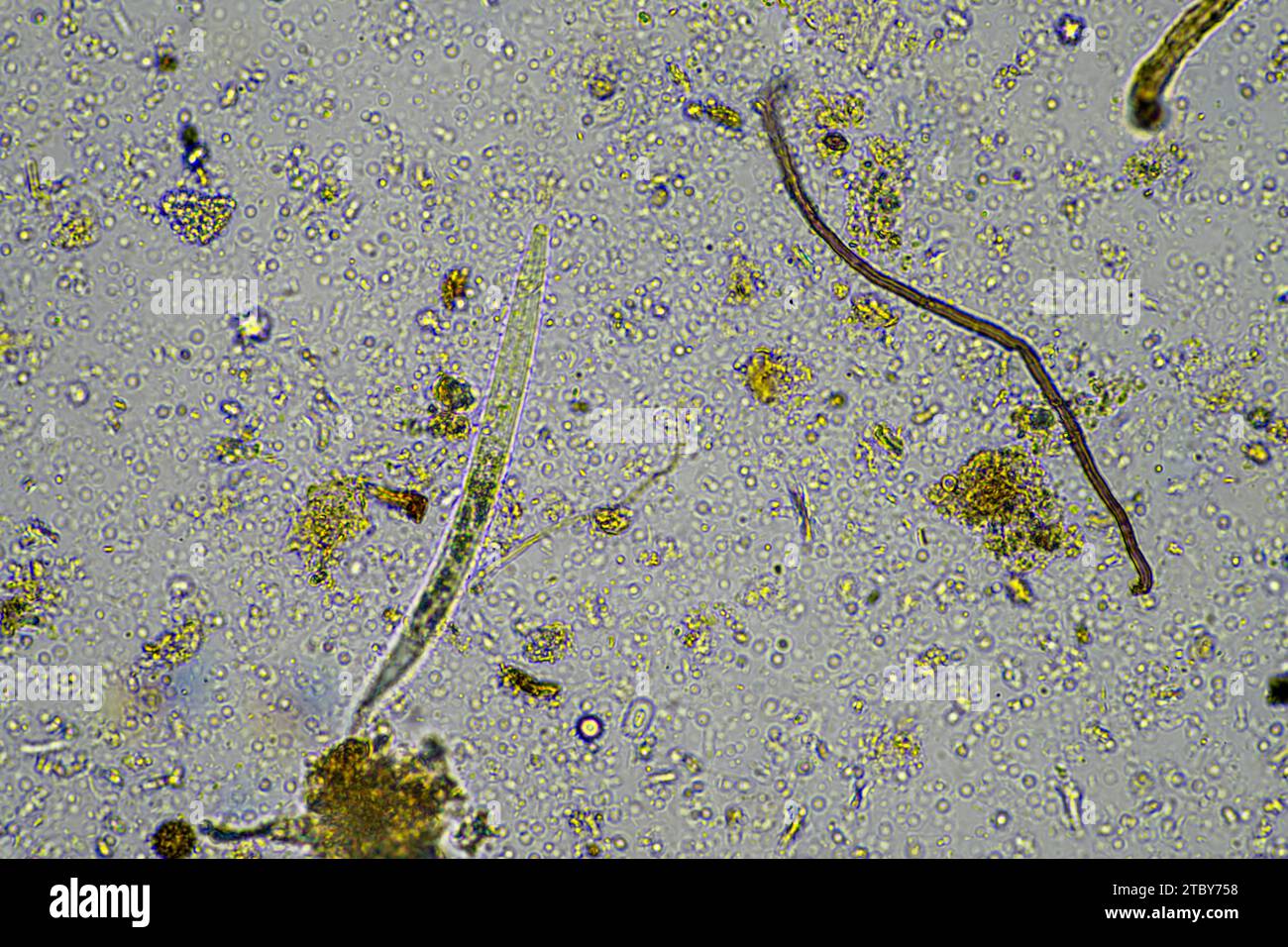 Microorganisms and biology in Compost and soil sample under the ...