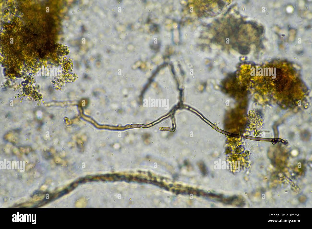 soil microbes under the microscope. microorganisms with fungus in ...