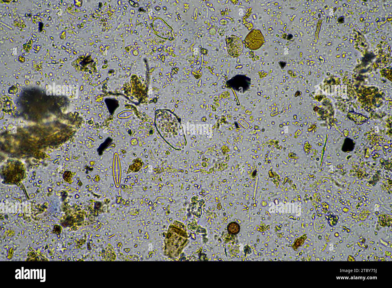 Microorganisms and biology in Compost and soil sample under the ...