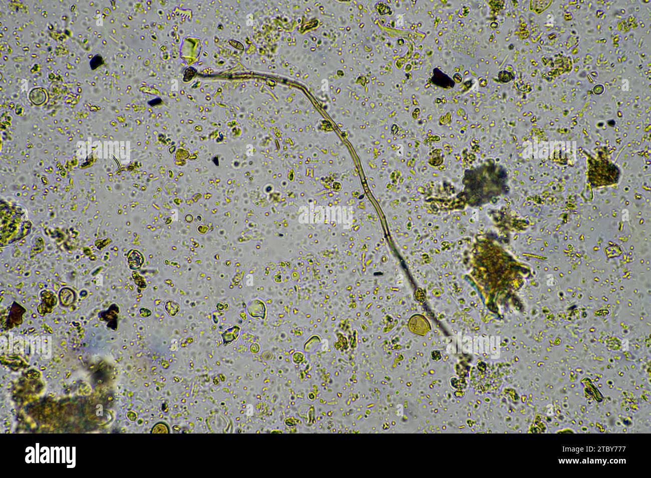 microscopic microorganisms under the microscope Stock Photo - Alamy