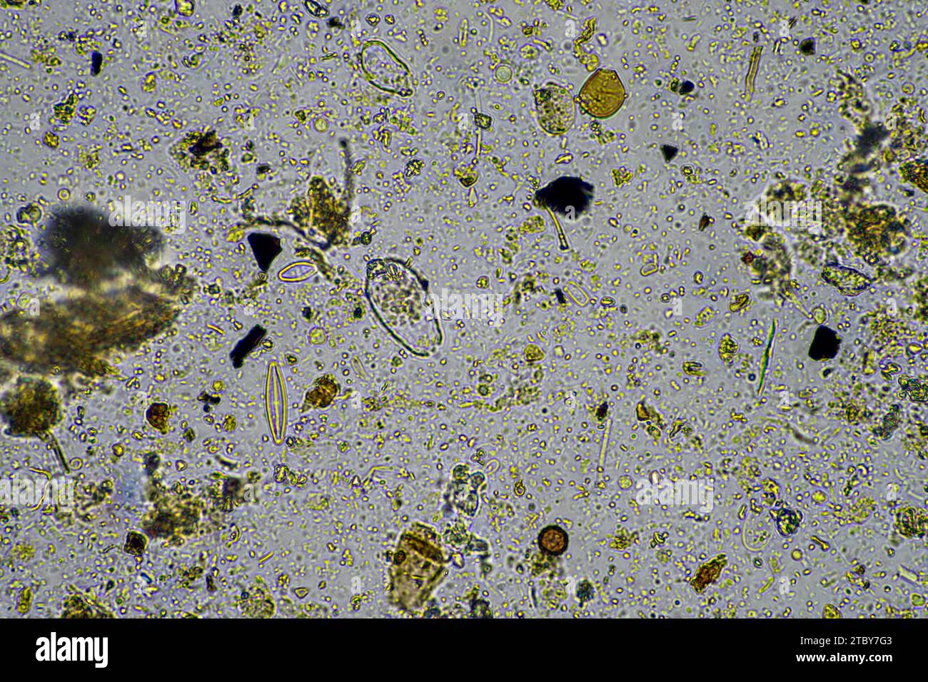 microscopic microorganisms under the microscope Stock Photo - Alamy