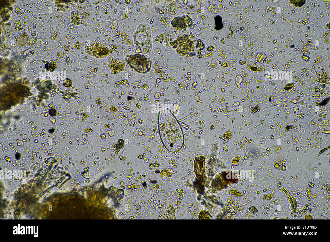 soil microbes under the microscope. microorganisms with fungus in ...