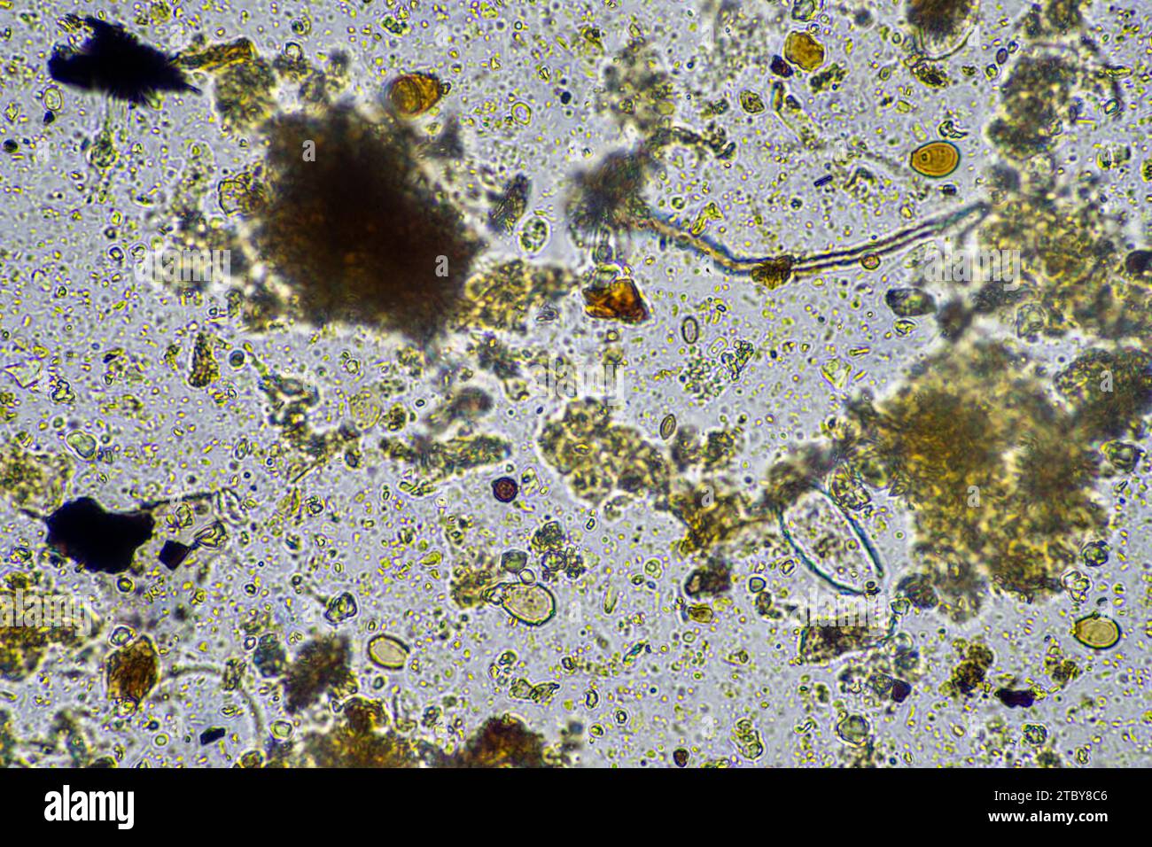 microscopic microorganisms under the microscope Stock Photo - Alamy