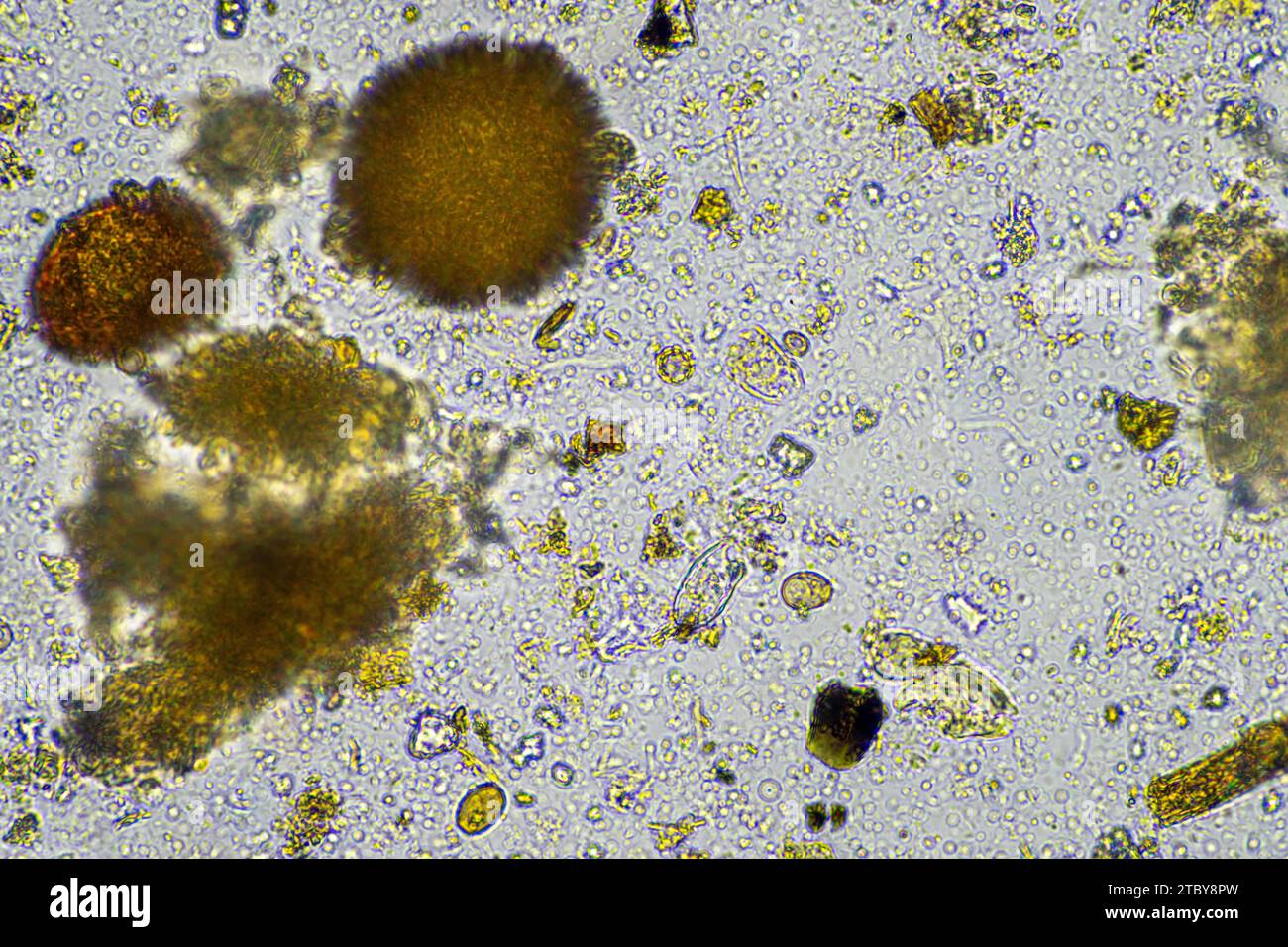 soil microbes under the microscope. microorganisms with fungus in ...