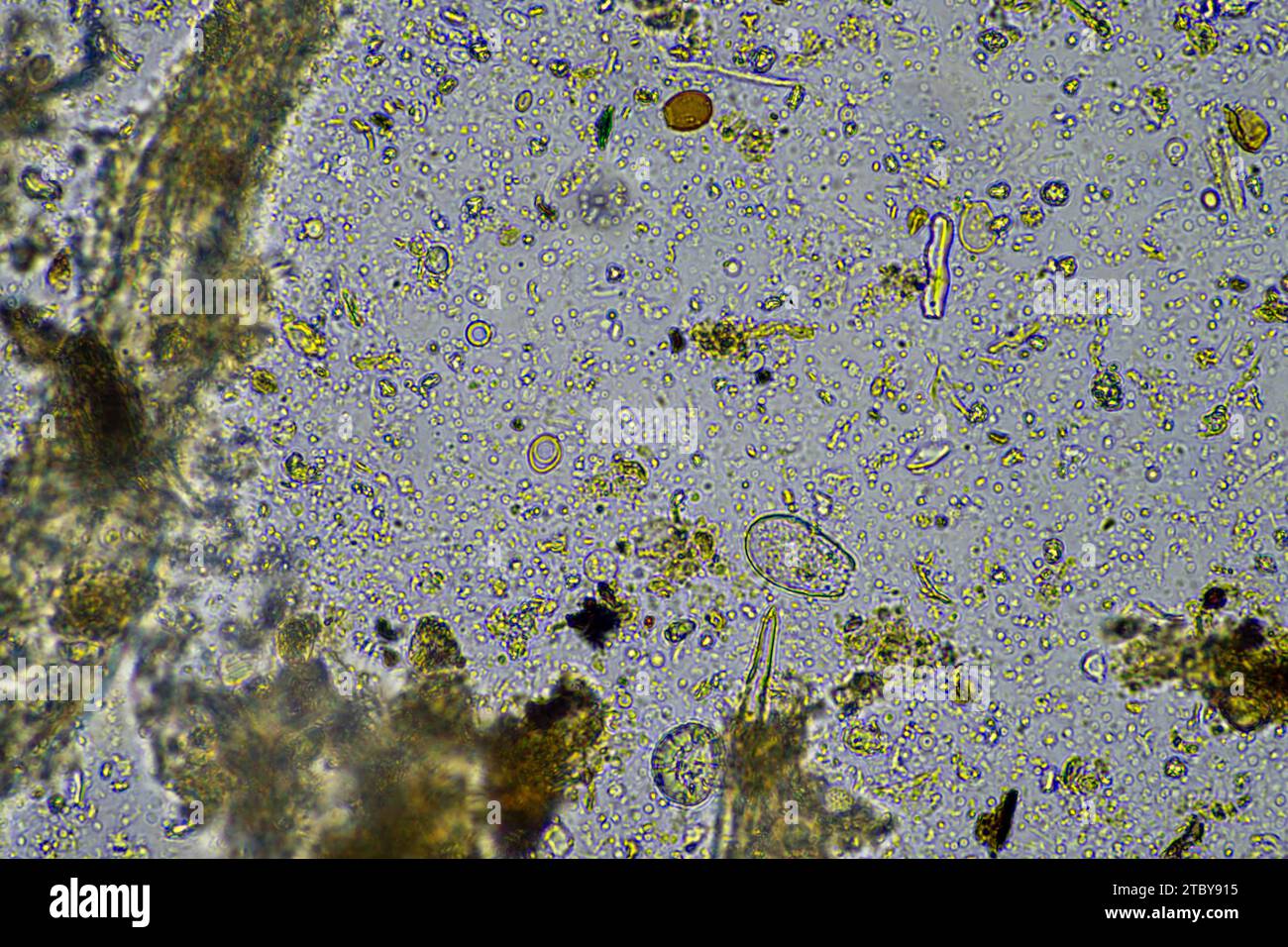 microscopic microorganisms under the microscope Stock Photo - Alamy
