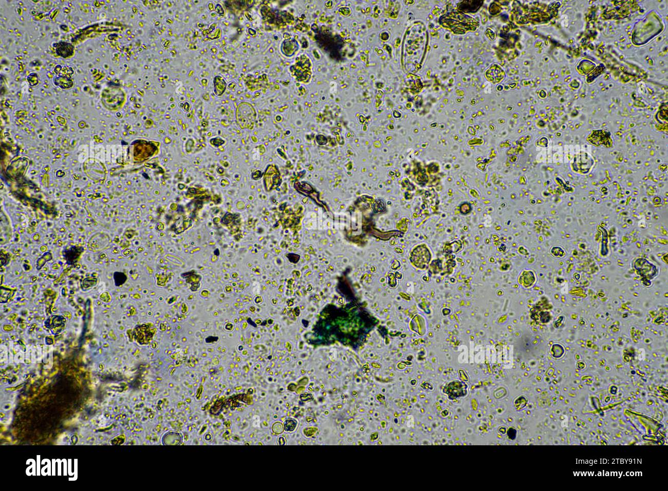Microorganisms and biology in Compost and soil sample under the ...