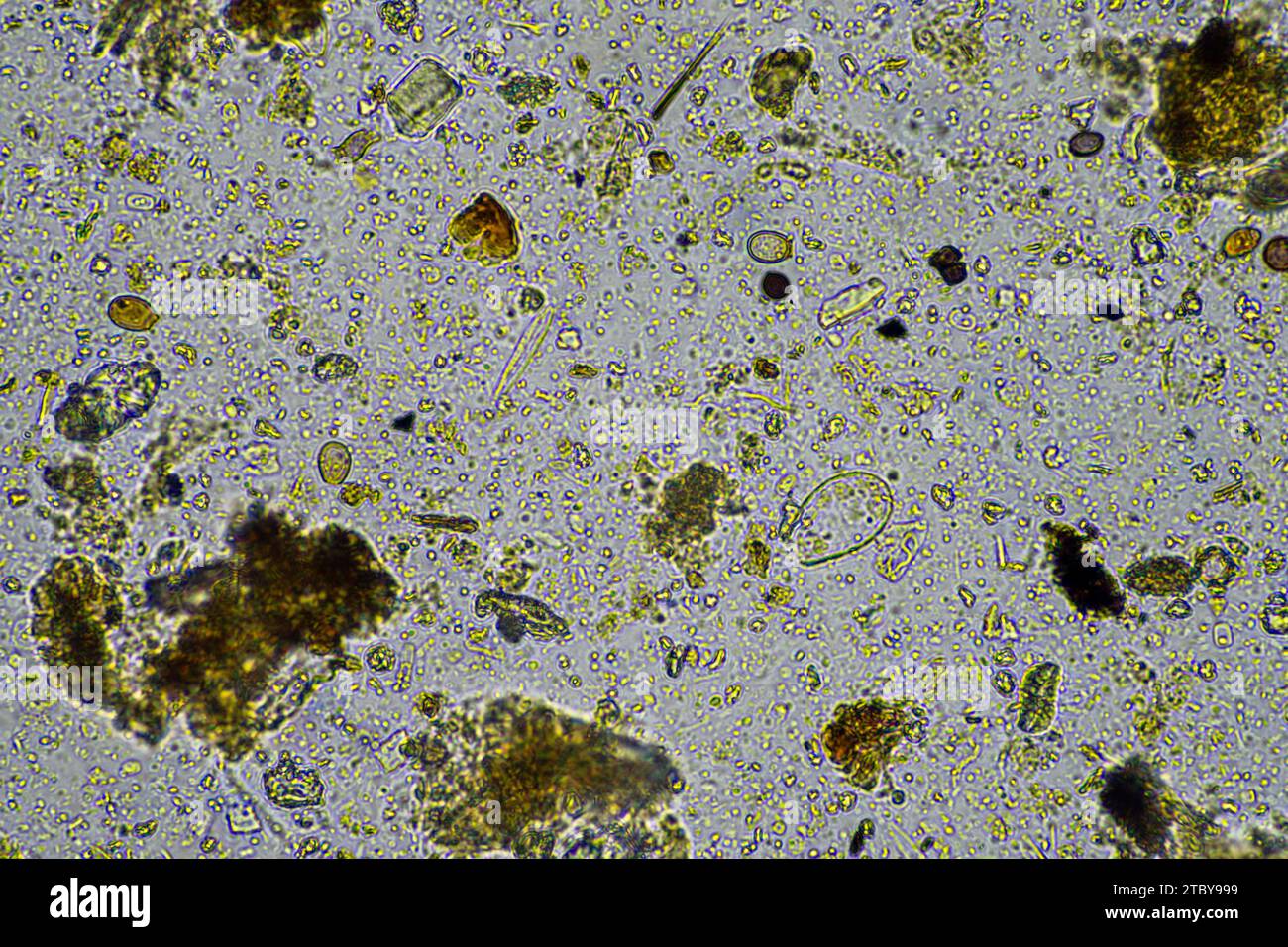 Microorganisms and biology in Compost and soil sample under the ...