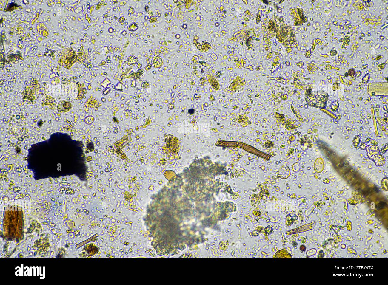 microscopic microorganisms under the microscope Stock Photo - Alamy