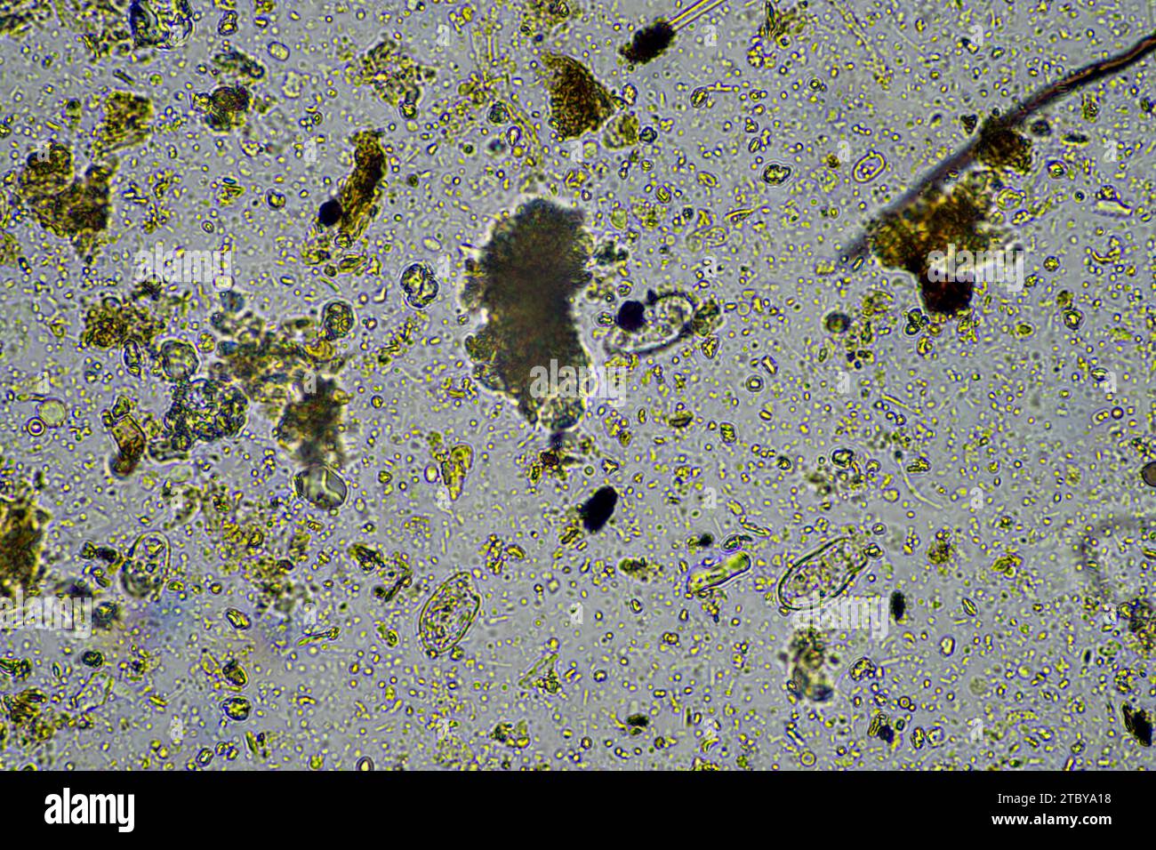 soil microbes under the microscope. microorganisms with fungus in ...