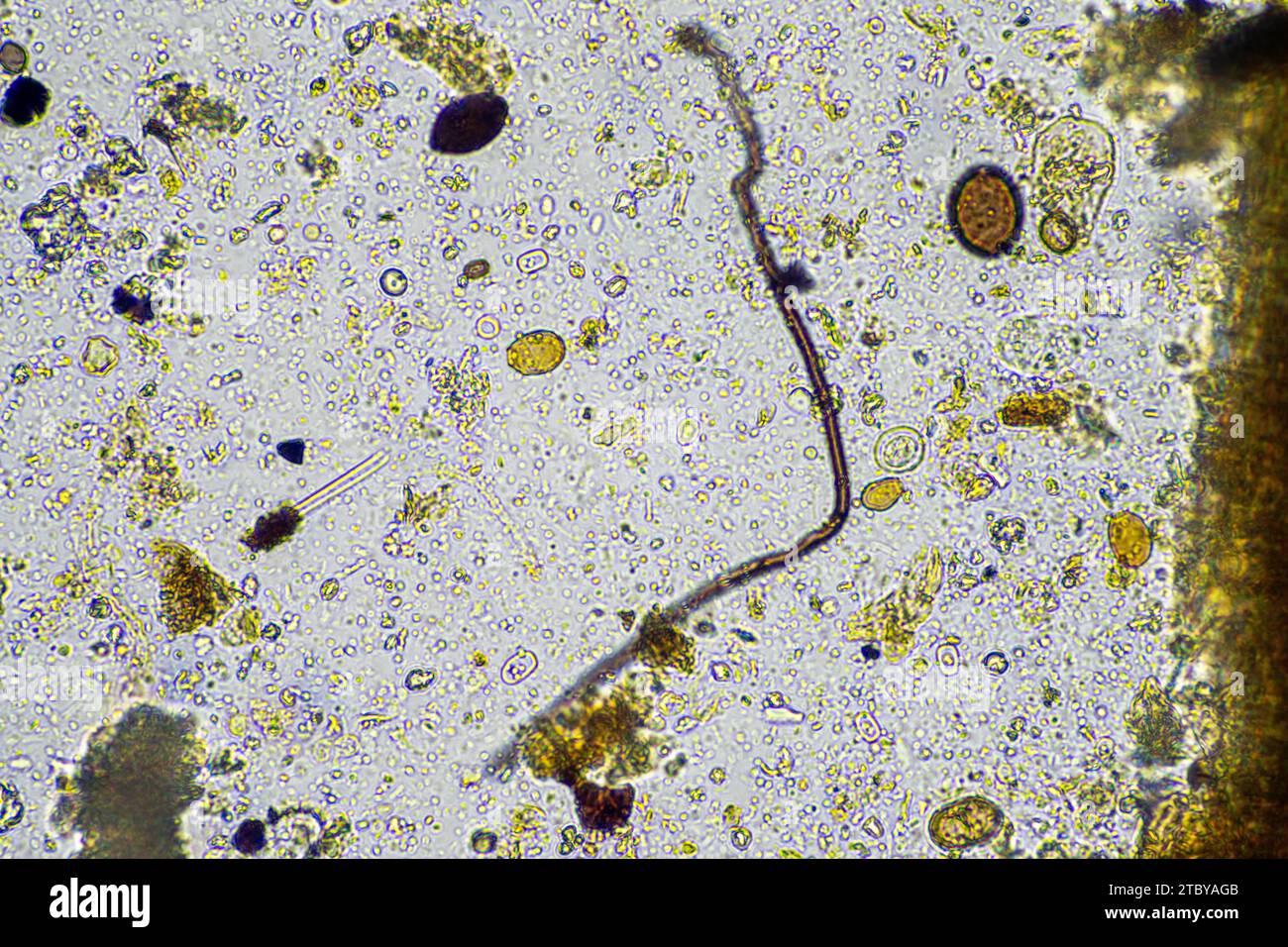 Microorganisms and biology in Compost and soil sample under the ...