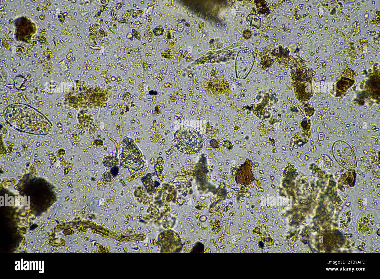 soil microbes under the microscope. microorganisms with fungus in ...