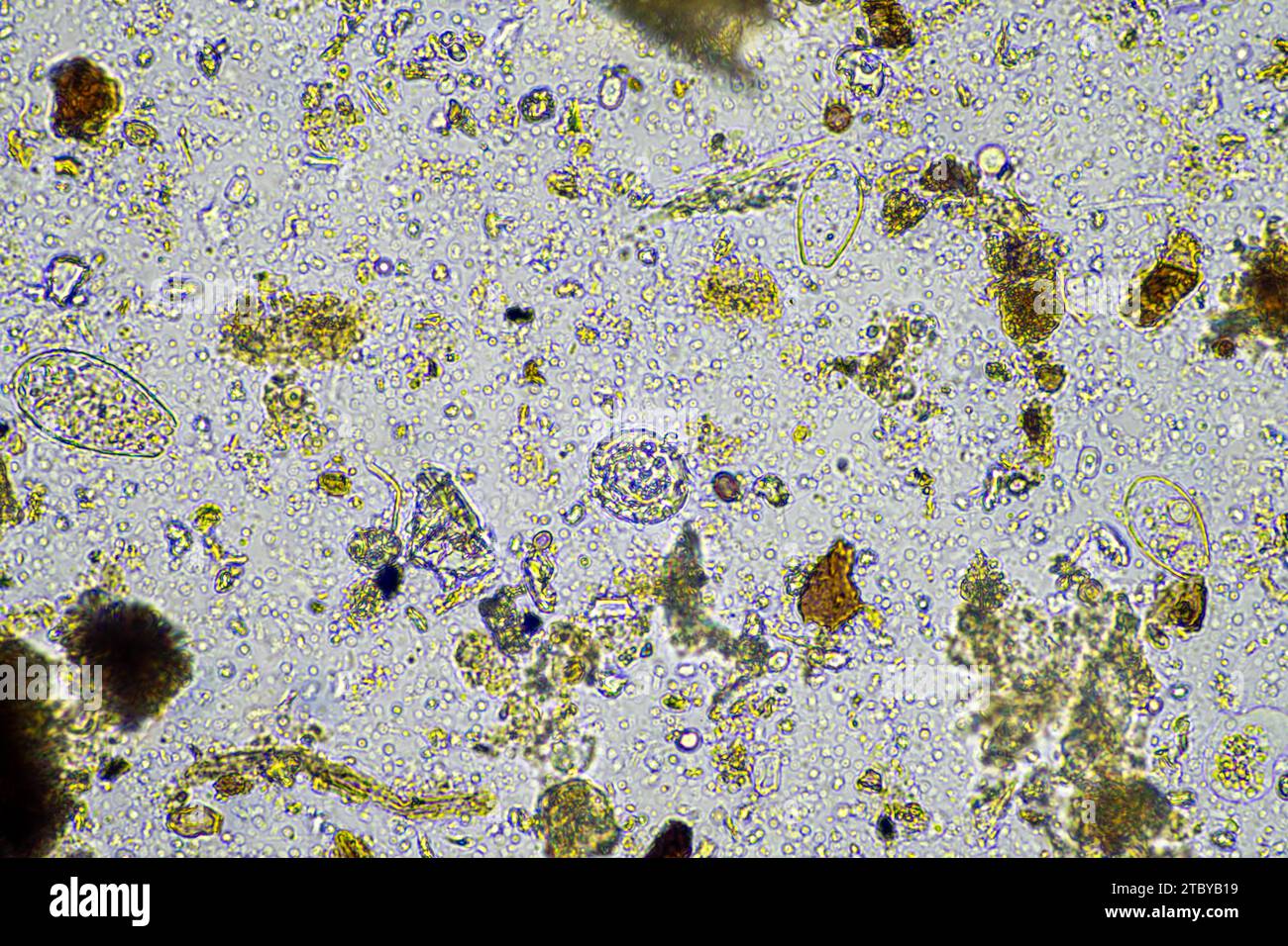 Microorganisms and biology in Compost and soil sample under the ...
