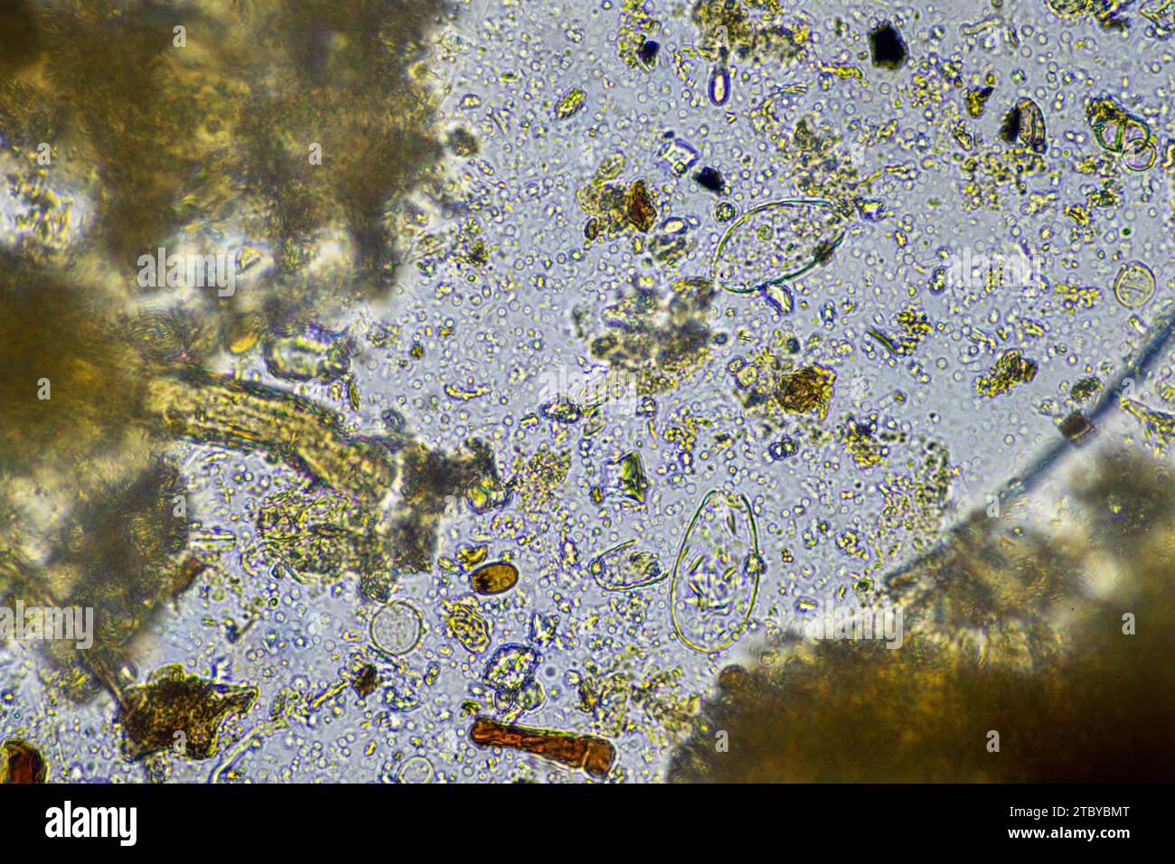 microscopic microorganisms under the microscope Stock Photo - Alamy